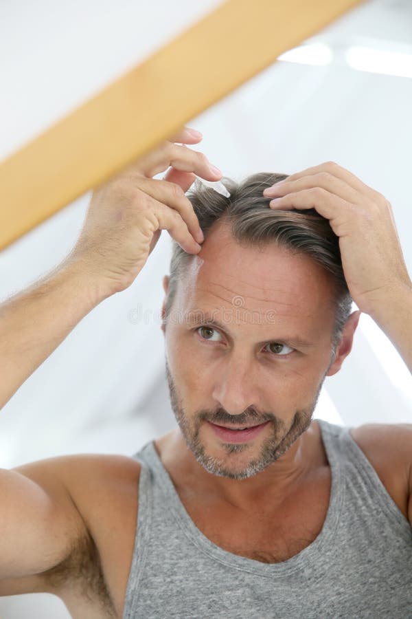 Middle-aged Man Applying Hair Loss Treatment Stock Photo - Image of ...