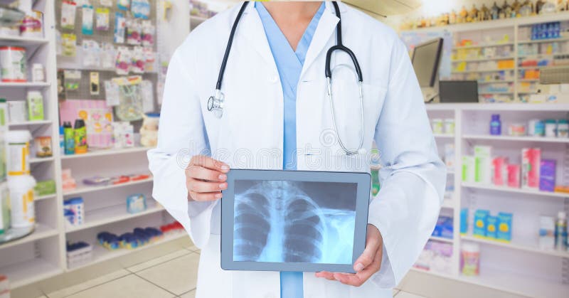 Midsection of Doctor Showing X-ray on Tablet PC in Pharmacy Stock Photo ...