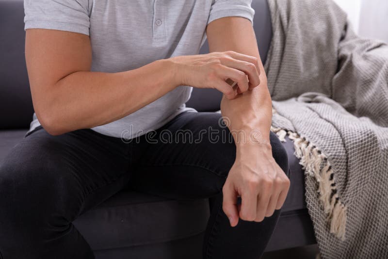 Man Suffering from Itching Skin, Close Up. Stock Image - Image of itchy ...
