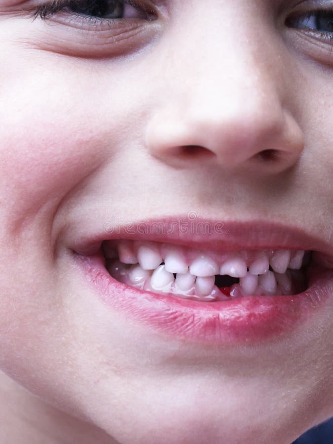 Losing first tooth stock photo. Image of baby, lost, child - 19848974