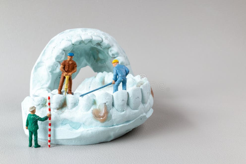 Miniature Workers Cleaning Teeth on Dental Mold Stock Image - Image of ...