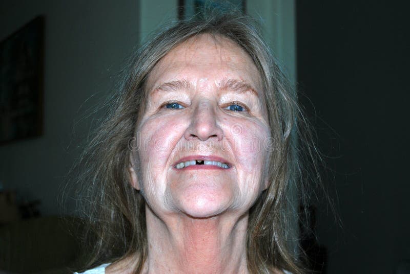 Missing tooth cap. stock image. Image of lifestyle, mature - 129531653