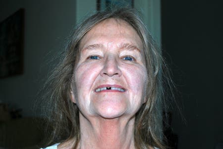 Missing tooth cap. stock image. Image of lifestyle, mature - 129531653