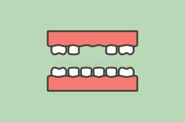 Teeth Gap Cartoon Stock Illustrations – 153 Teeth Gap Cartoon Stock ...