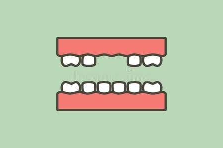 Teeth Gap Cartoon Stock Illustrations – 153 Teeth Gap Cartoon Stock ...