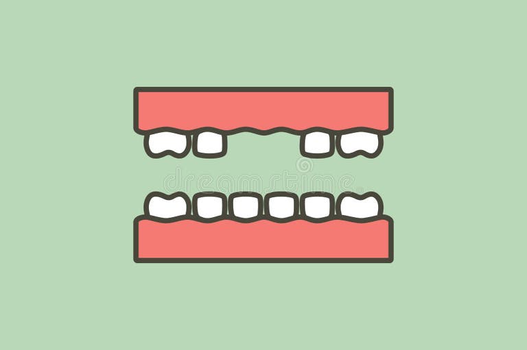 Missing Tooth Cartoon Stock Illustrations – 257 Missing Tooth Cartoon ...