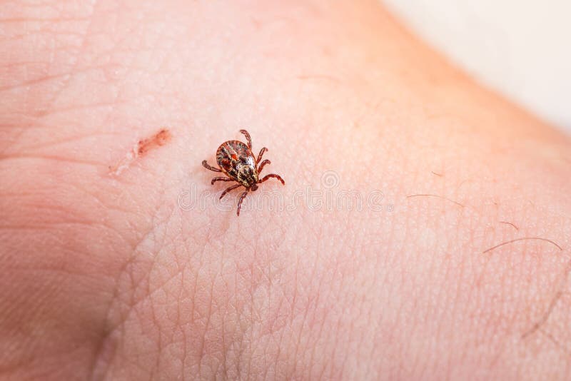 Danger Of Tick Bite. Shows Close-up Mite In The Hand. Stock Image ...