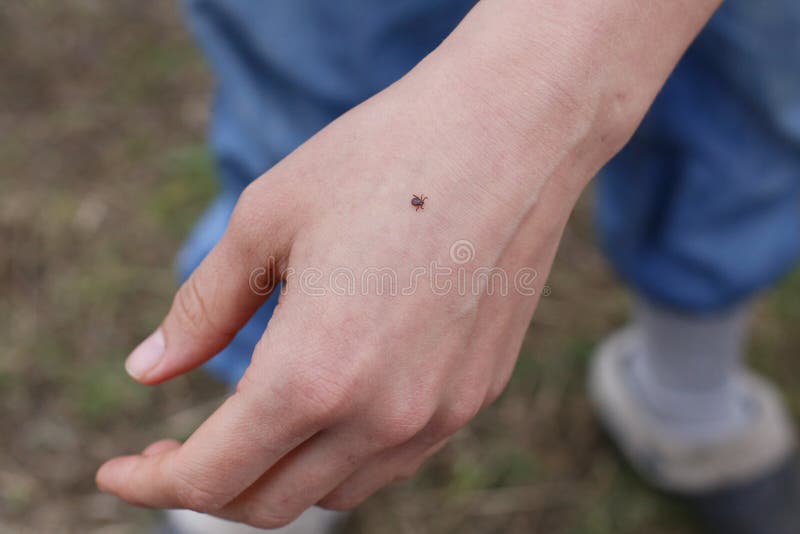 Mite stock image. Image of bite, encephalitis, ease, pest - 39626153