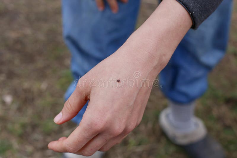Mite stock photo. Image of mite, bloodsucking, virus - 39626234