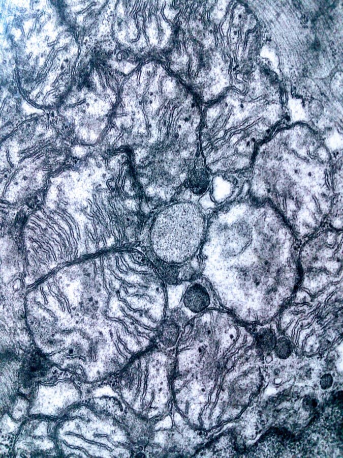Mitochondria Micrograph