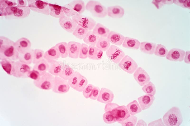 Mitosis Cell of Root Tip of Onion Under the Light Microscope Stock ...