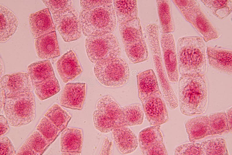 Mitosis Cell in the Root Tip of Onion Under a Microscope. Stock Image ...