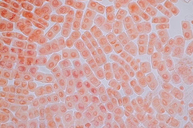 Mitosis Cell in the Root Tip of Onion Under a Microscope. Stock Photo ...