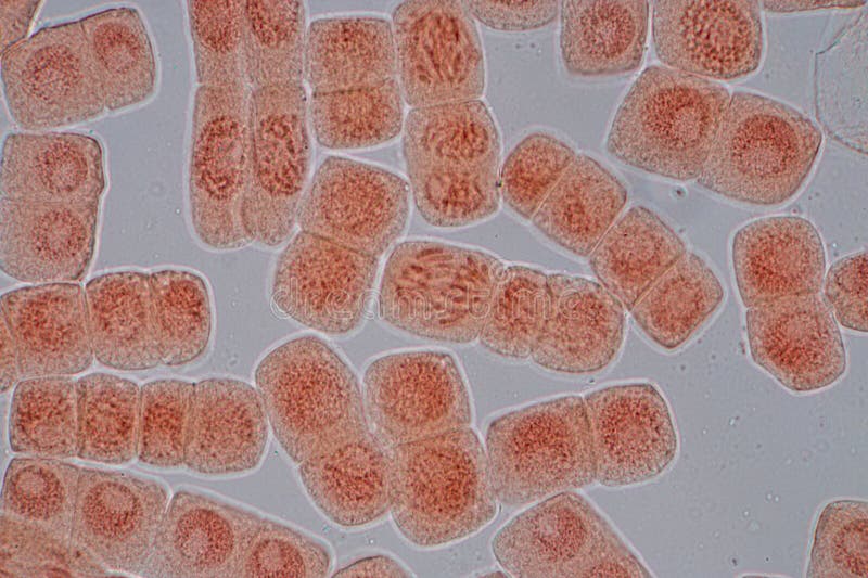 Mitosis Cell in the Root Tip of Onion Under a Microscope. Stock Image ...