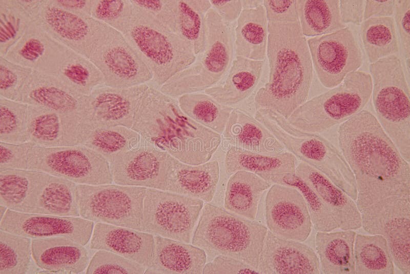 Mitosis Cell in the Root Tip of Onion Under a Microscope. Stock Photo ...