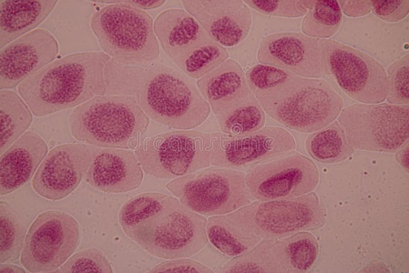 Mitosis Cell in the Root Tip of Onion Under a Microscope. Stock Photo ...