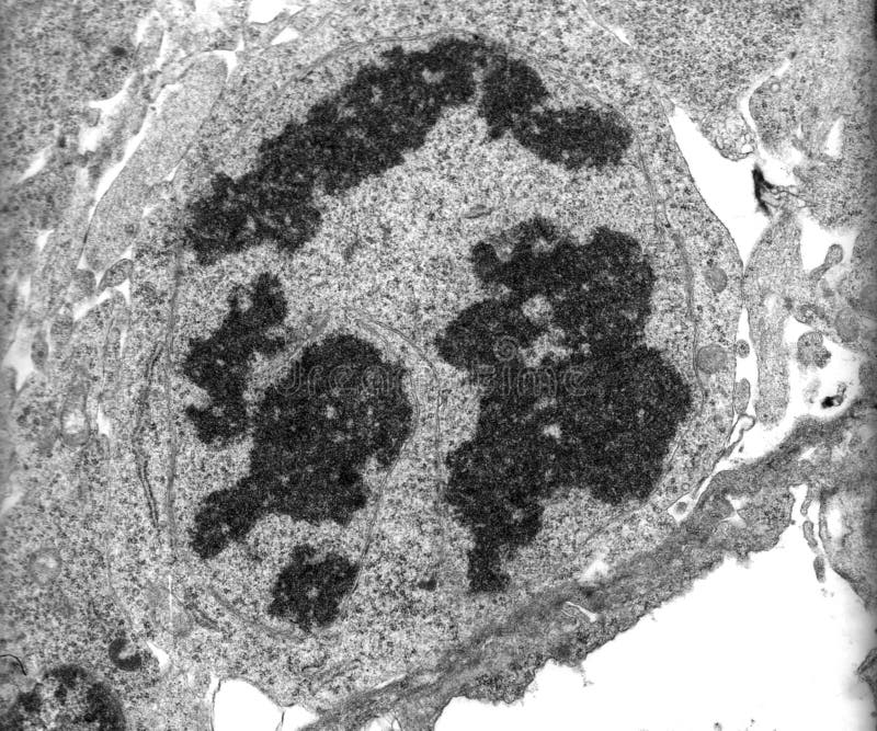 Mitosis. TEM micrograph stock image. Image of biology - 117240447