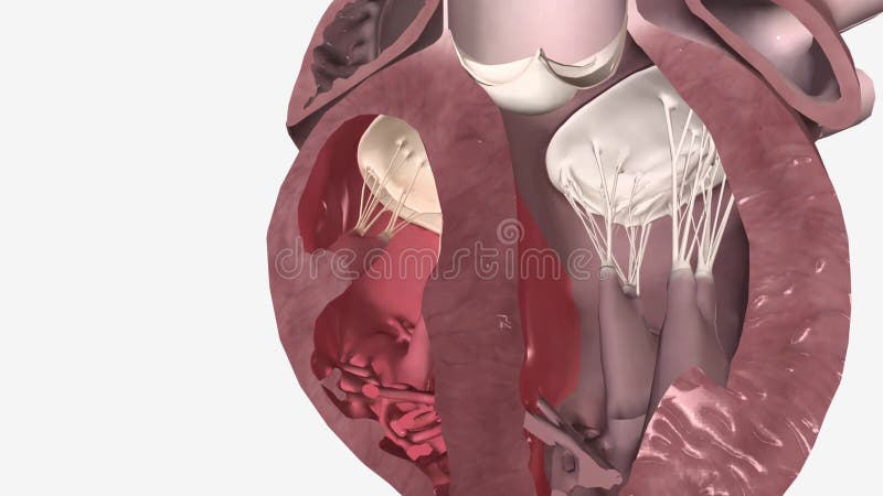 The Mitral Valve is Located between the Upper Left Heart Chamber (left ... The Mitral Valve is Located between the Upper Left Heart Chamber (left ...