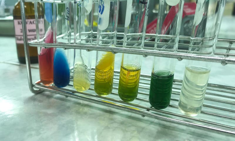 Mix Biochemical Test in Microbiology Laboratory Stock Image - Image of ...