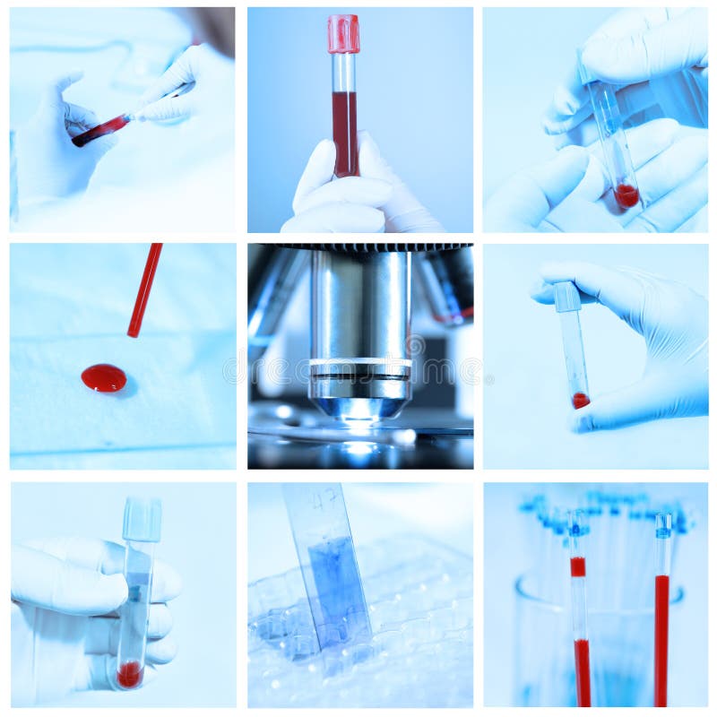 Mix of Blood Test in a Laboratory Stock Photo - Image of hospital ...
