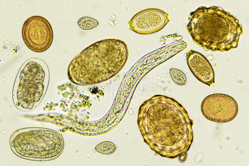 Mixed of Helminths or Parasitic Worm in Stool Stock Image - Image of ...