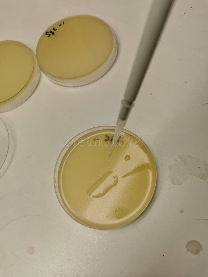 0.01ml of Solution Being Placed on an Agar Plate Using a Micropipette Stock Photo - Image of ...