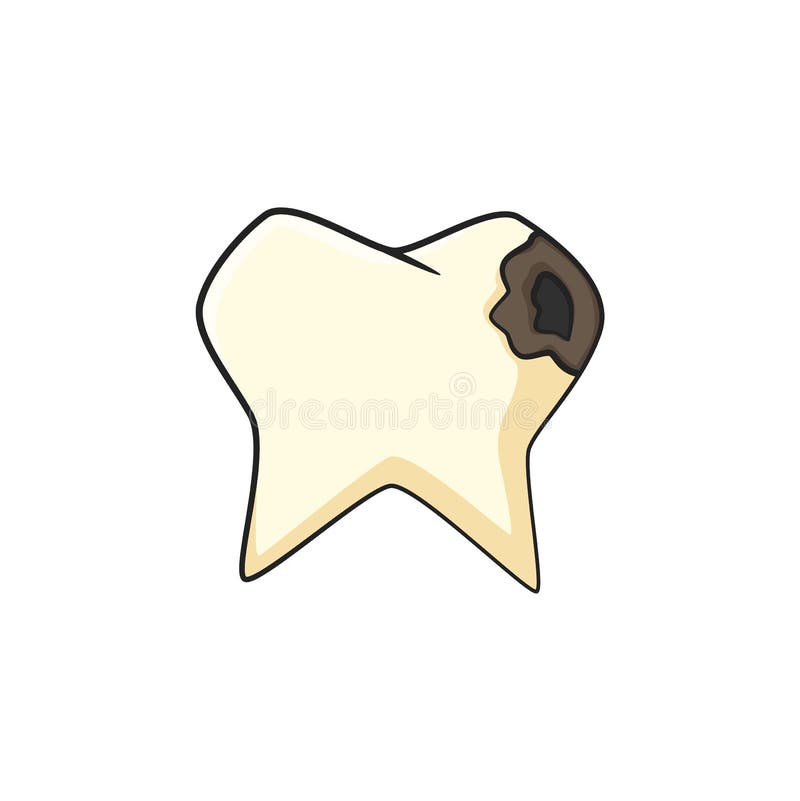 Decayed Tooth in Drawing Style Isolated . Stock Vector - Illustration ...