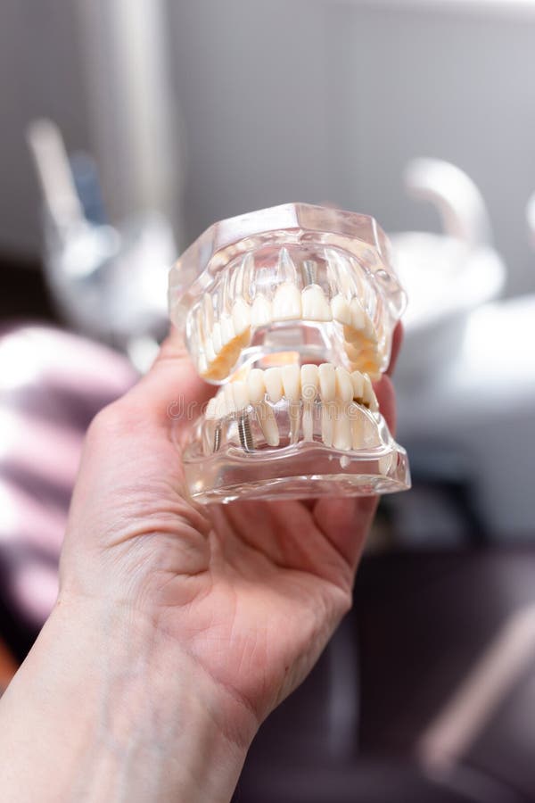 Mock Up Jaw with Teeth Holds in Hand Stock Photo - Image of healthy ...