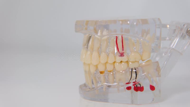 Mock-up Jaws on White Background with Reflection Teeth Skeleton Plastic ...