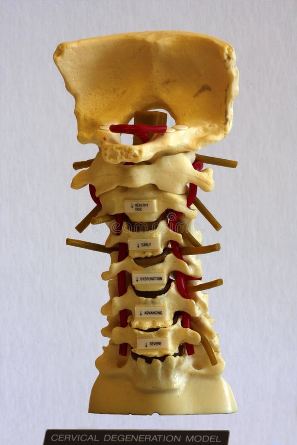 Spinal model stock image. Image of lumbo, anatomical - 14399389
