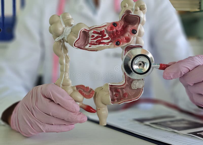Model of Human Digestive System Under Examination Stock Photo - Image ...