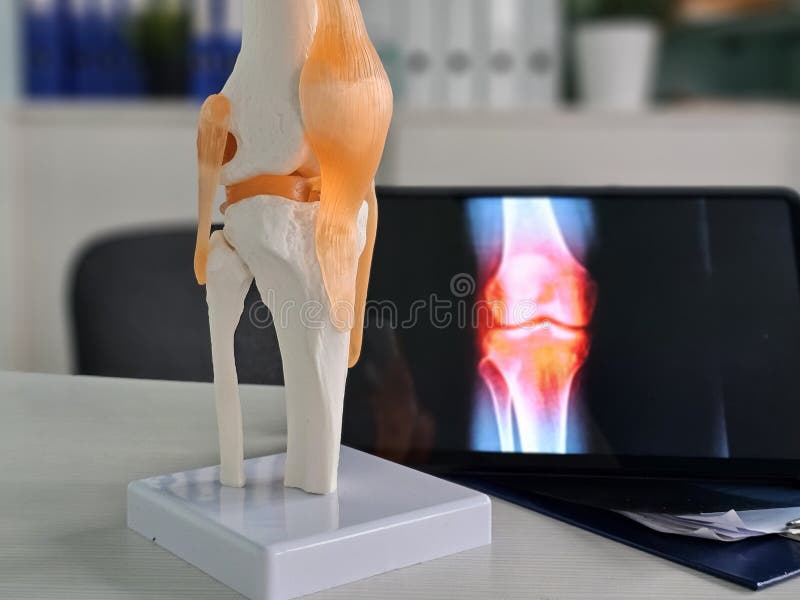 Model of a Human Knee Joint with Highlighted MRI Scan Displayed on a ...