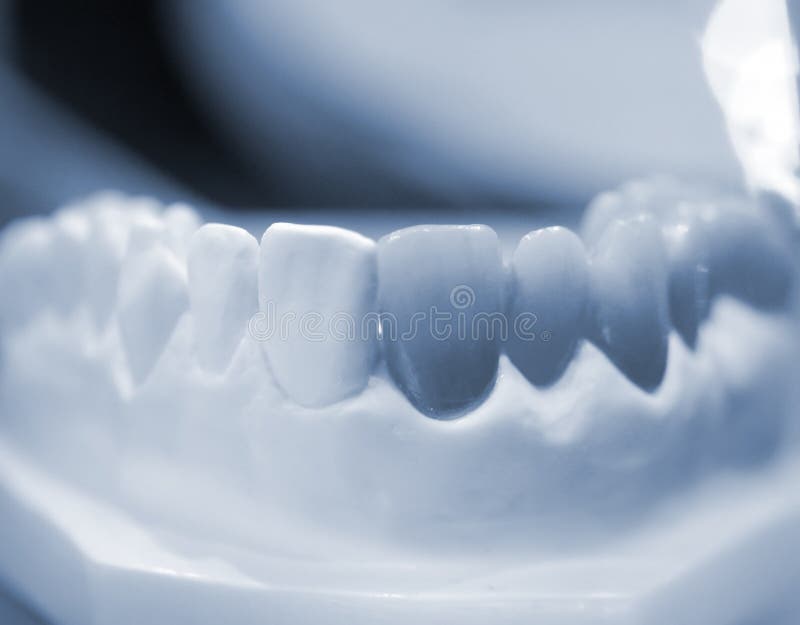 Model of Human Teeth with Artificial Teeth Close-up. Stock Photo ...