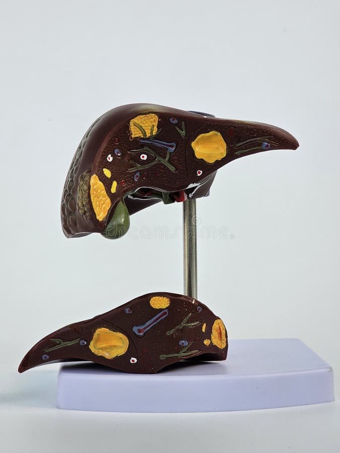 Model of Liver Anatomy Showcasing Detailed Internal Structures Stock ...