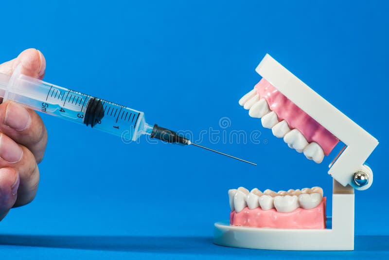 Model of teeth stock photo. Image of plaque, teeth, dental - 75600288