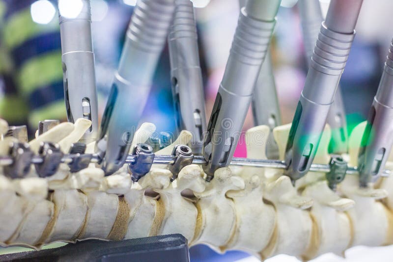 Modeling a Sample of Human Spine for Spinal Cord Therapy Stock Photo ...