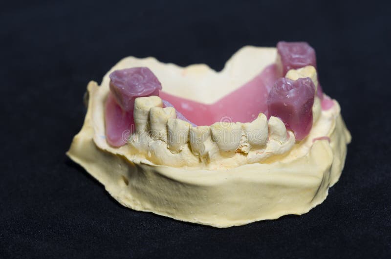 Modelo Dental Con Los Dientes Hechos En Cera Imagen de archivo - Imagen ...
