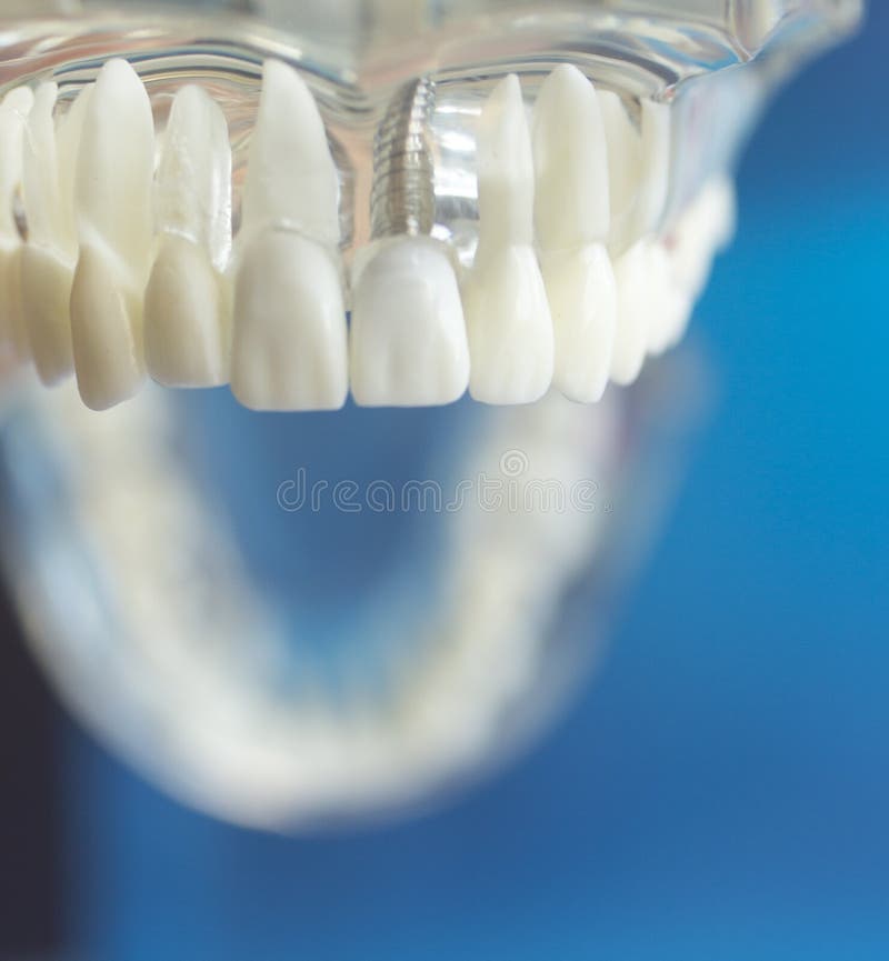 Modelo Dental De La Boca De Los Dientes Foto de archivo - Imagen de ...