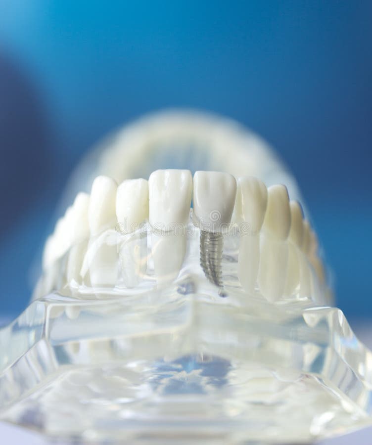 Modelo Dental De La Boca De Los Dientes Foto de archivo - Imagen de ...