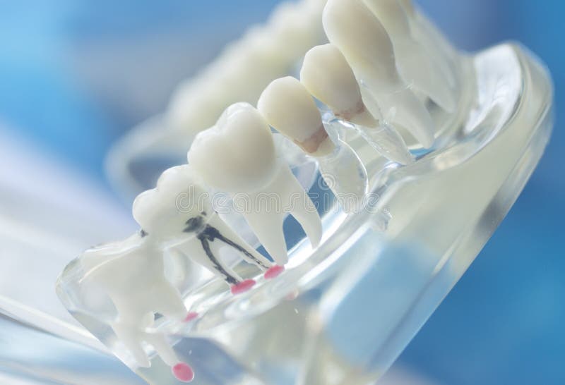 Modelo Dental De La Boca De Los Dientes Foto de archivo - Imagen de ...