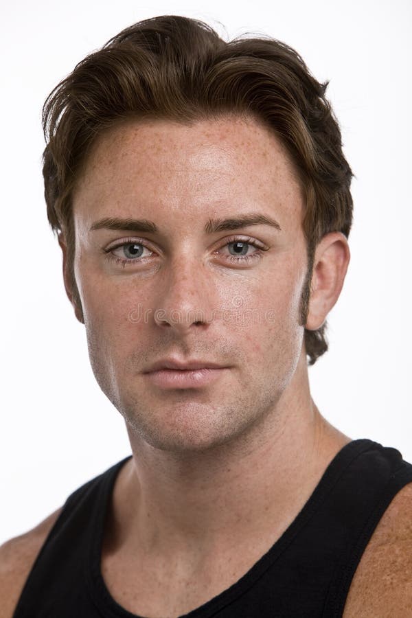 Ojo dañado foto de archivo. Imagen de accidente, magullado - 5215396