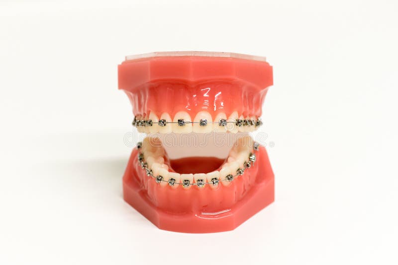 Dientes frontales imagen de archivo. Imagen de higiene - 28494585