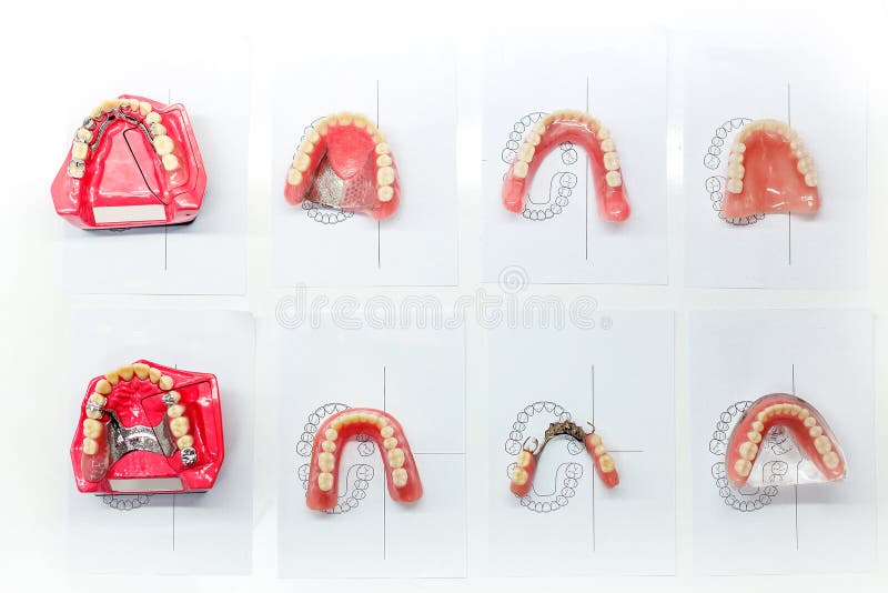 Models of dental crown stock photo. Image of hygiene - 132030856
