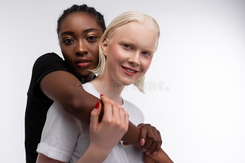 Two Models With Different Skin Color Posing For Diversity Article Stock ...