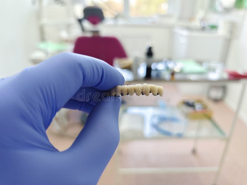 Modern Ceramic-metal Dental Bridge for Restoring Dentition Stock Photo ...