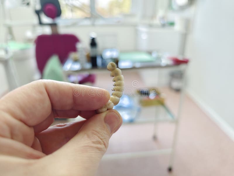 Modern Ceramic-metal Dental Bridge for Restoring Dentition Stock Photo ...