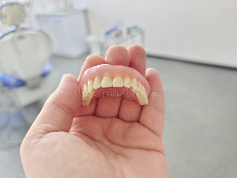 Complete Removable Denture Based on Acrylic Stock Image - Image of ...