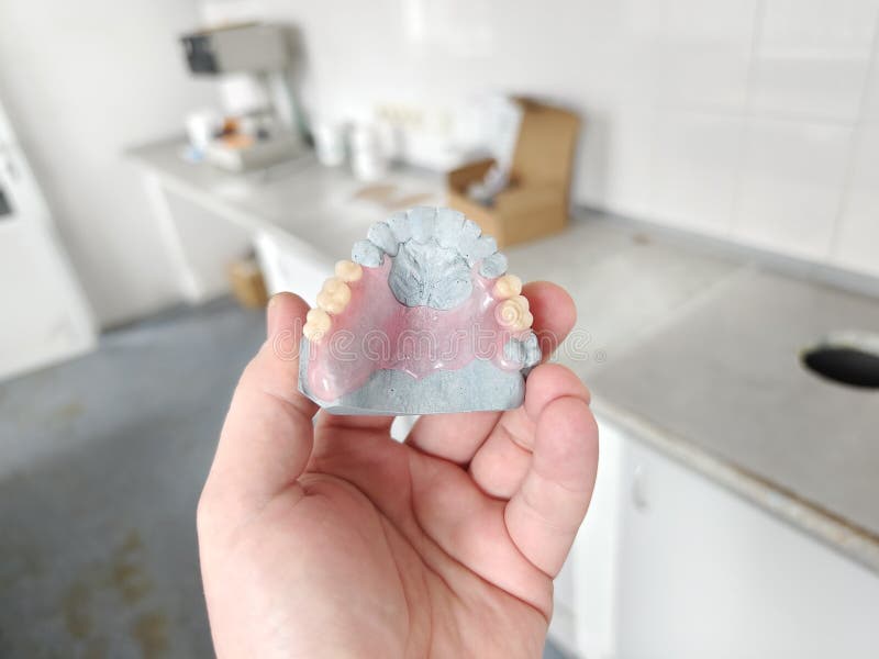 Modern Removable Nylon Prosthesis on a Plaster Model Stock Photo ...