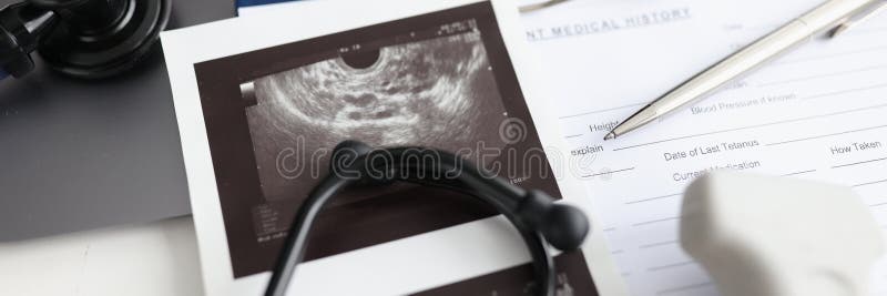 Modern Ultrasound Device with Sensor and Ultrasound of Uterus Stock ...