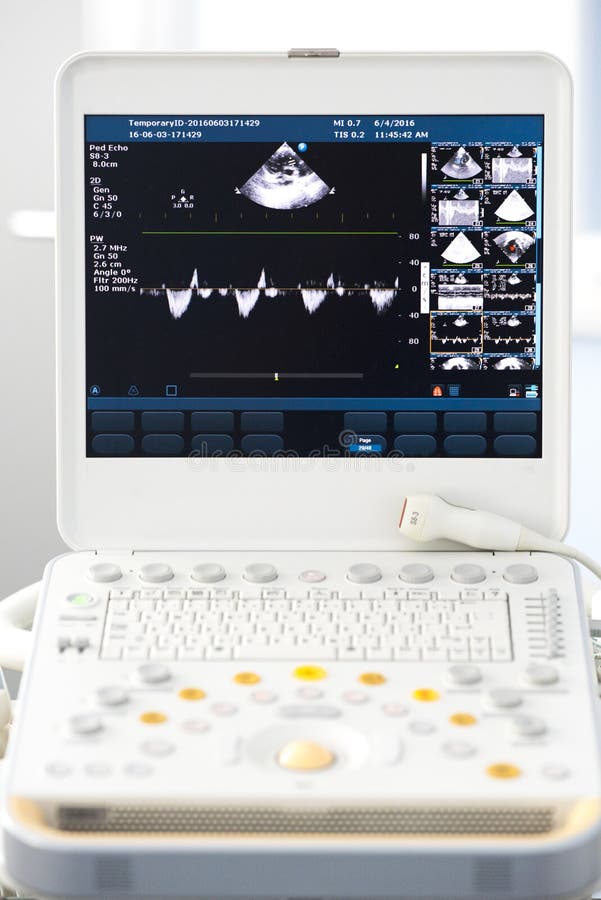 Modern ultrasound machine stock photo. Image of healthcare - 72661414